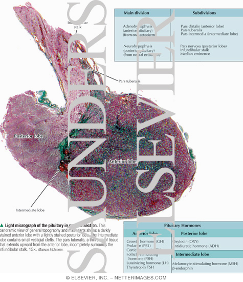 Watermarked preview of labeled image: Light Micrograph of the Pituitary ...
