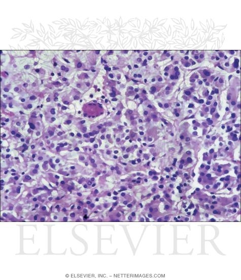 Light Micrograph of the Adrenal Medulla Showing the Irregular ...