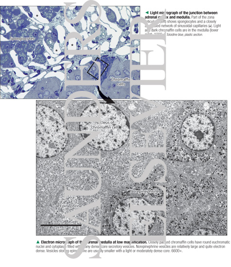 Light Micrograph of the Junction Between Adrenal Cortex and Medulla ...