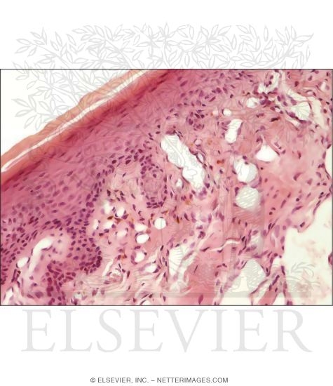 Light Micrograph of the Gingiva