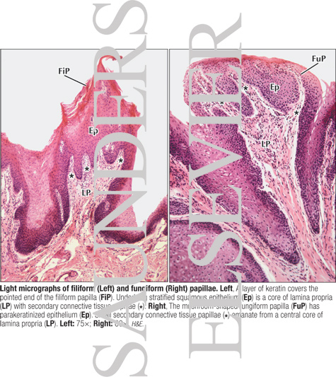 Light Micrographs of Filiform (Left) and Fungiform (Right) Papillae
