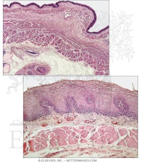 Light Micrograph of the Wall of the Esophagus With Higher Magnification ...