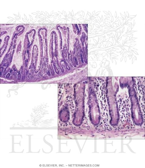 Light Micrograph of Part of the Ileum With Light Micrograph of the ...