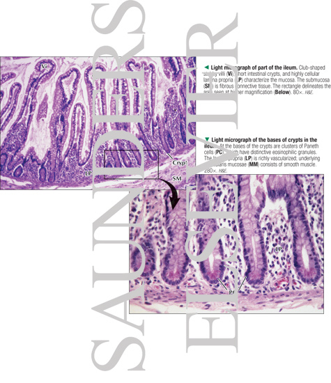 Light Micrograph of Part of the Ileum With Light Micrograph of the ...