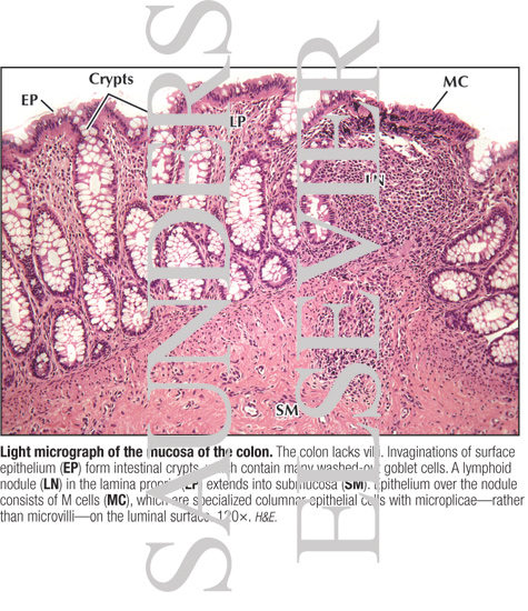 Light Micrograph of the Mucosa of the Colon