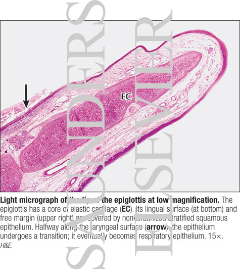 Light Micrograph of the Tip of the Epiglottis at Low Magnification