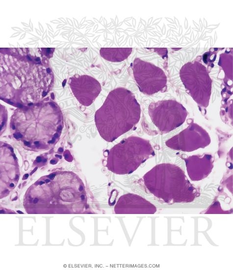 Light Micrograph of Part of the Vocalis Muscle of the Larynx