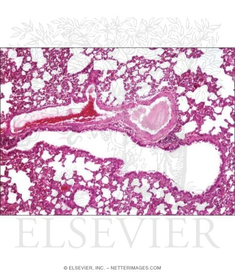 Light Micrograph of the Lung That Shows the Close Relationship Between ...
