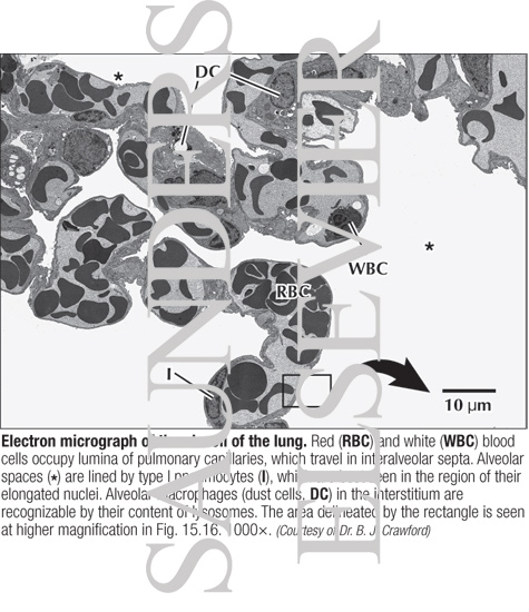 Electron Micrograph of the Alveoli of the Lung