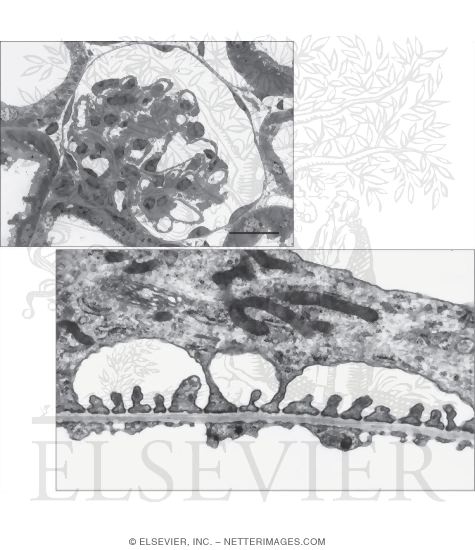 Electron Micrograph of a Renal Corpuscle at Low Magnification With ...