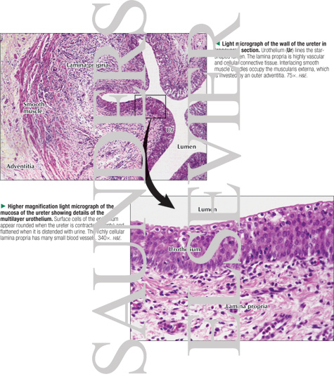 Light Micrograph of the Wall of the Ureter In Transverse Section With ...