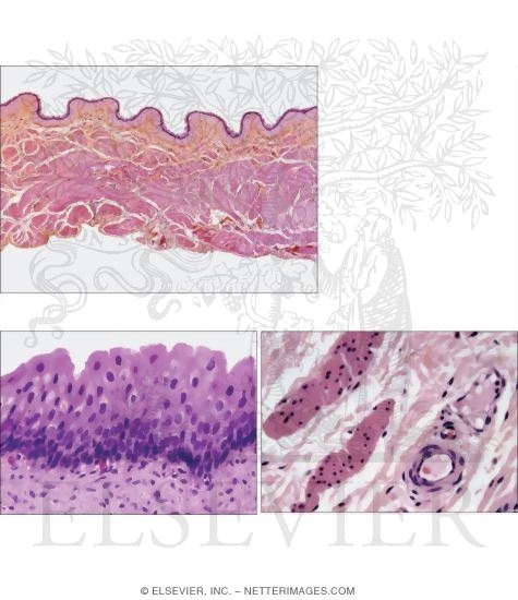 Light Micrograph of the Wall of the Urinary Bladder In Transverse ...
