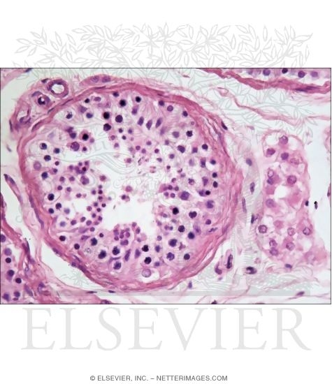 Light Micrograph of a Seminiferous Tubule In Transverse Section