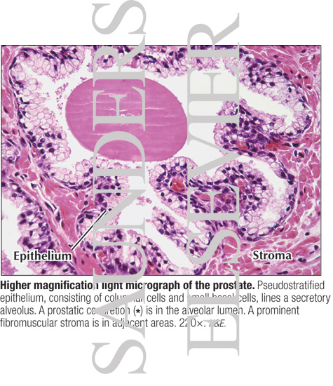 Higher Magnification Light Micrograph of the Prostate