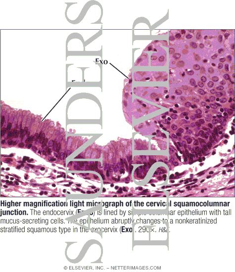 Higher Magnification Light Micrograph of the Cervical Squamocolumnar ...