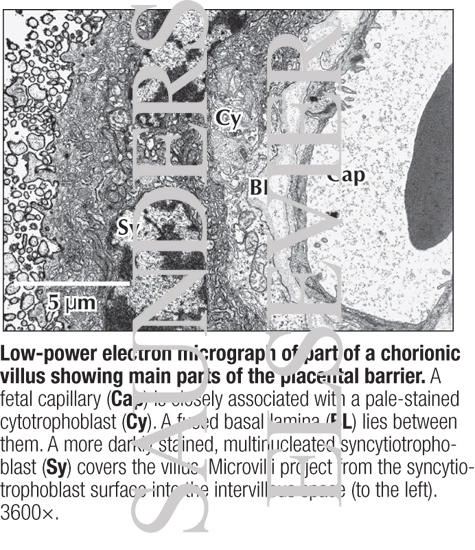 Low-power Electron Micrograph of Part of a Chorionic Villus Showing ...