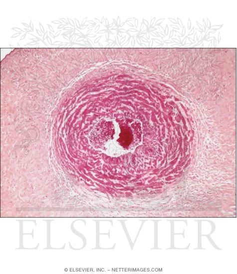The Umbilical Artery In Transverse Section
