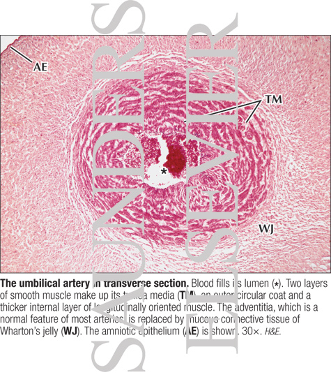The Umbilical Artery In Transverse Section