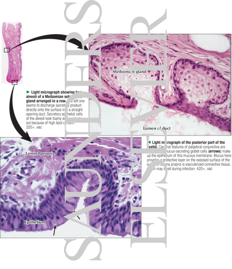 Light Micrograph Showing Two Alveoli of a Meibomian Sebaceous Gland ...