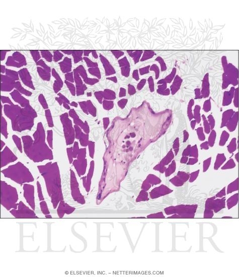 Light Micrograph of a Muscle Spindle In Transverse Section