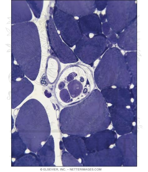 Light Micrograph of a Muscle Spindle In the Equatorial Region