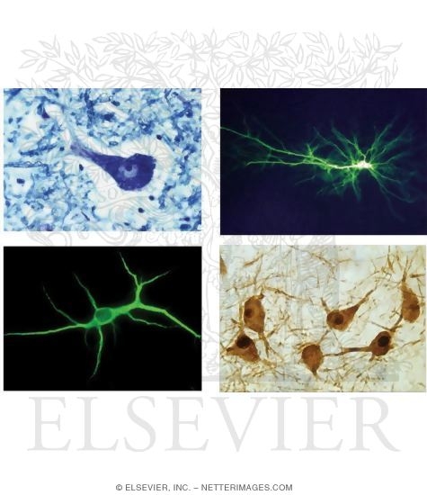 Light Micrographs of Central Nervous System Neurons Treated With ...