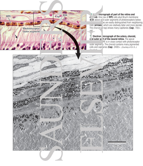 Light Micrograph of Part of the Retina and Choroid With Electron ...