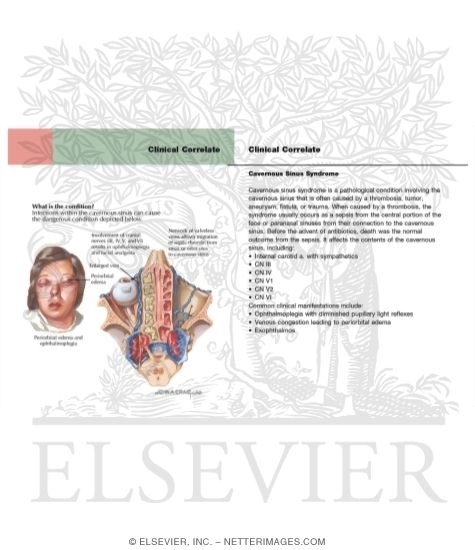 Cavernous Sinus Netter