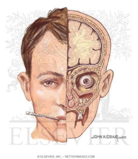 Sinusitis