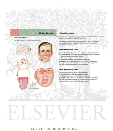 Hypoglossal Nerve (CN-XII)