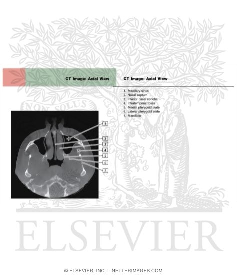 CT Image: Axial View