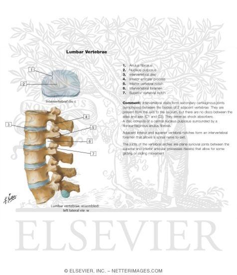 Lumbar Vertebrae and Intervertebral Disc Spine: Osteology