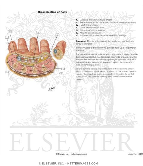 Spaces, Bursae, and Tendon and Lumbrical Sheaths of Hand Bursae, Spaces ...