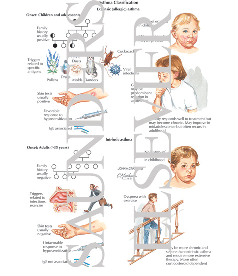 Asthma Classification