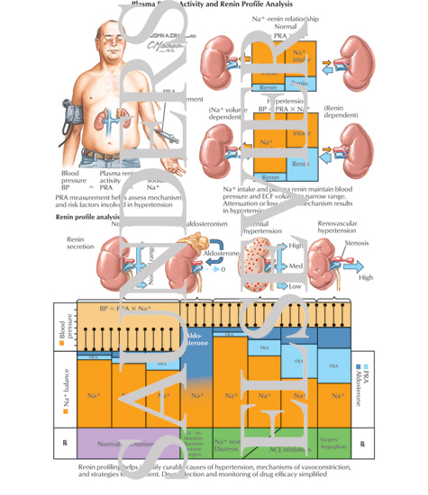 Plasma Renin Activity and Renin Profile Analysis