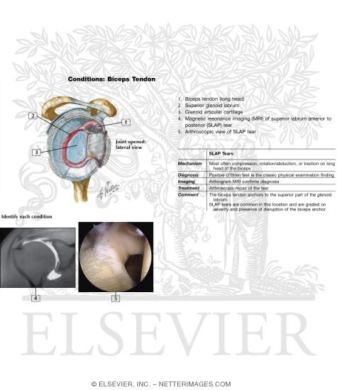 Shoulder: Glenohumeral Joint