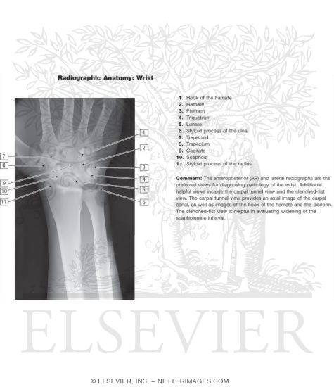 Radiographic Anatomy of the Wrist