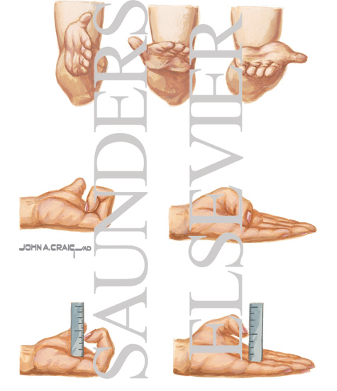 Physical Examination: Elbow, Wrist, and Hand