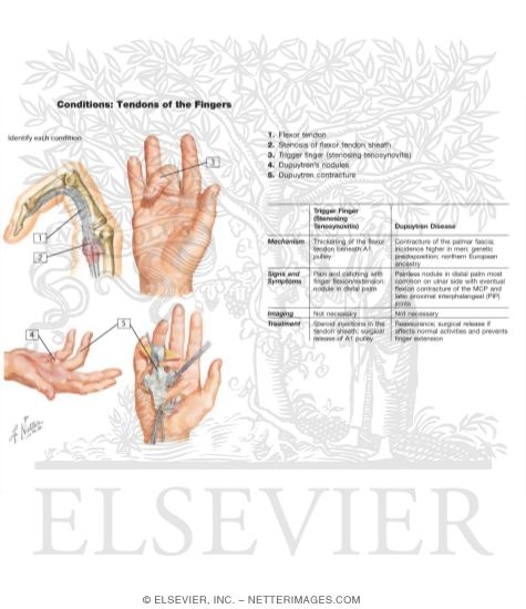 Tendons of the Fingers