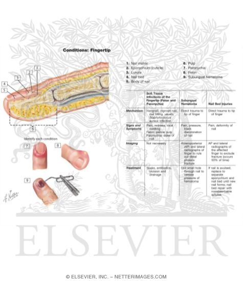 Conditions of the Fingertip