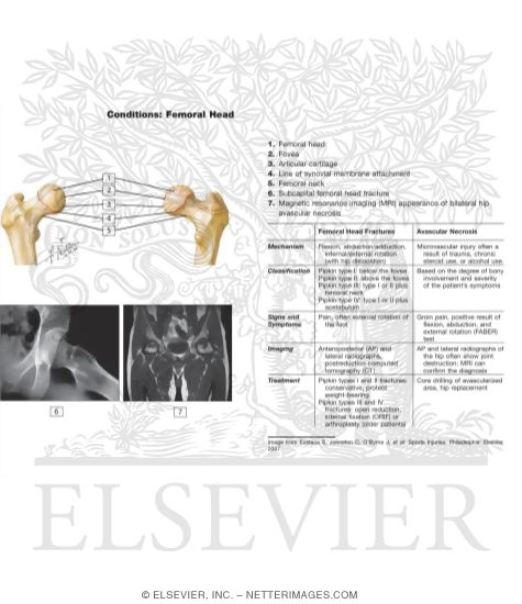 Osteology of the Femur