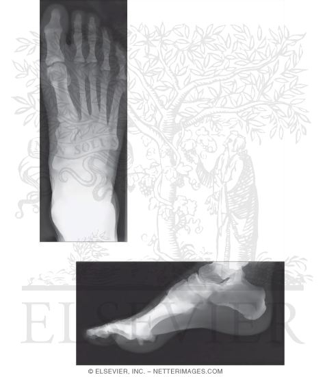 Radiographic Anatomy of the Foot