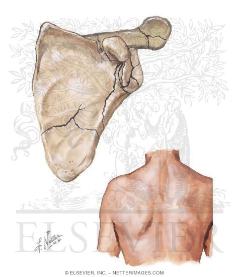 Left Scapula Pain