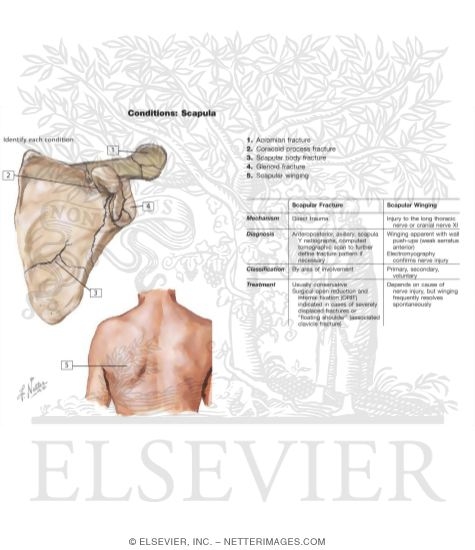 Conditions of the Scapula