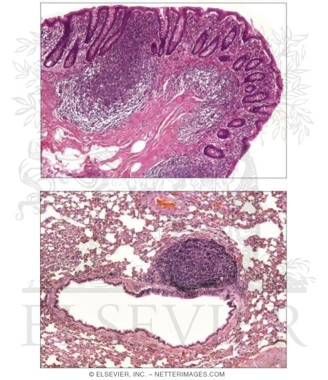 Lymphoid Tissue Lymphoid Tissue