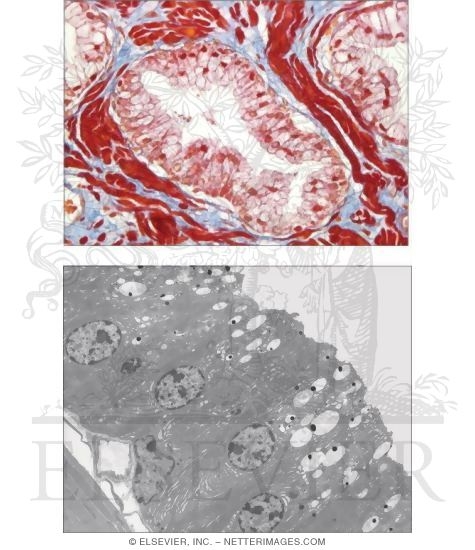 Prostatic Epithelium
