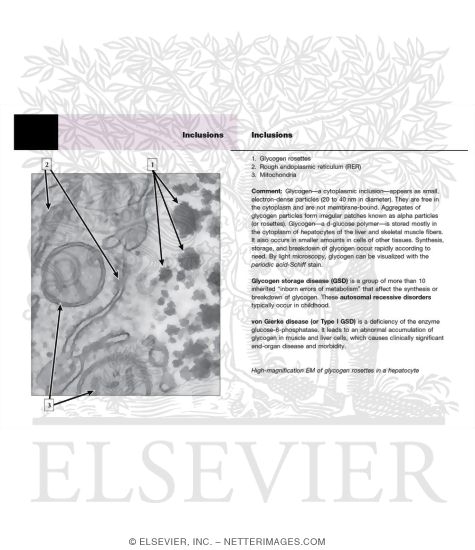 Electron Micrograph of Glycon In the Cytoplasm of a Hepatocyte