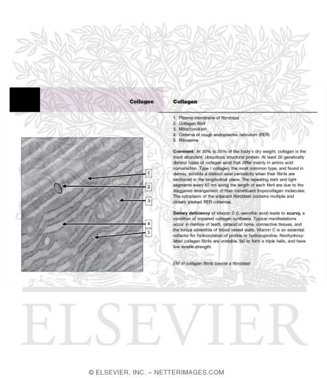 Electron Micrograph of Collagen Fibrils Beside a Fibroblast