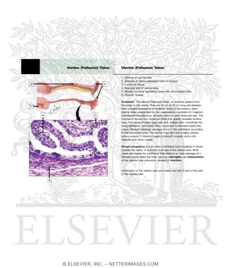 Uterine (Fallopian) Tubes