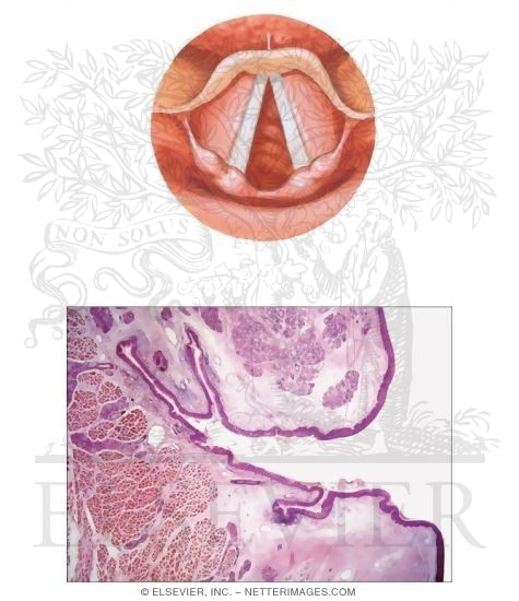 Larynx Histology Labeled